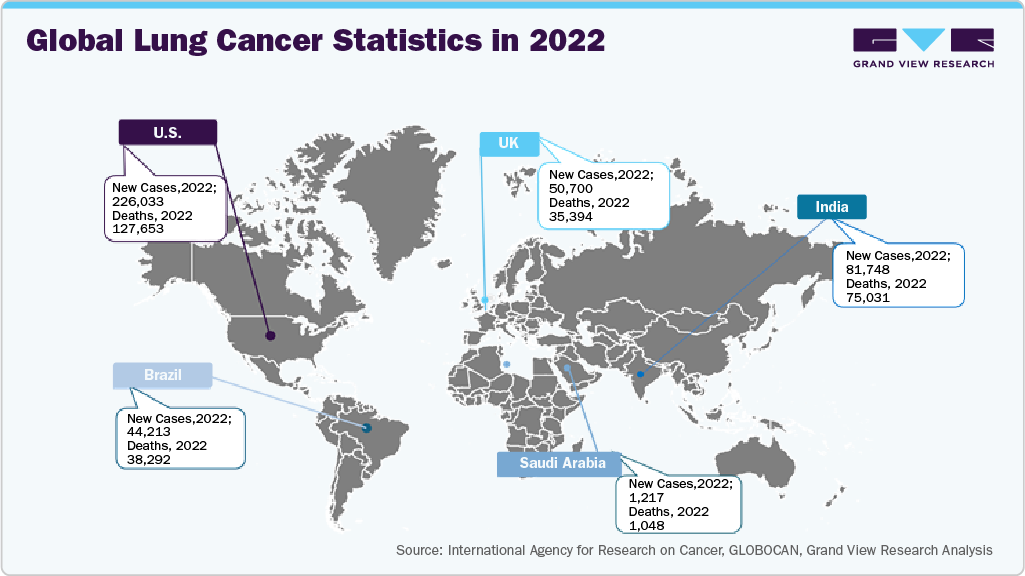 Endoscopic Ultrasound Market Size | Industry Report, 2030